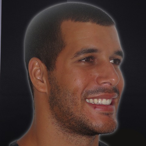 Dr. Rafael Cabral – Cirurgia Ortognática